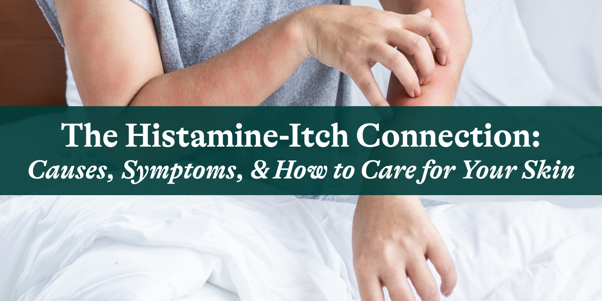 The Histamine-Itch Connection: Causes, Symptoms, and How to Care for Y ...